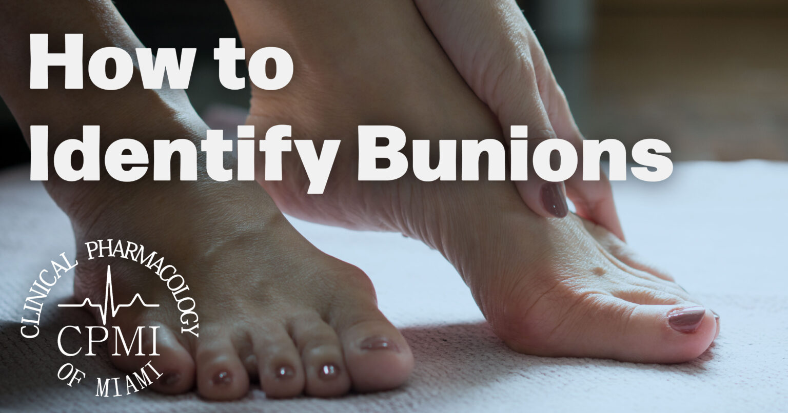 How to Identify Bunions: Signs and Symptoms - Clinical Pharmacology of ...